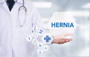 How to Choose the Right Hernia Truss for You - Health Benefits
