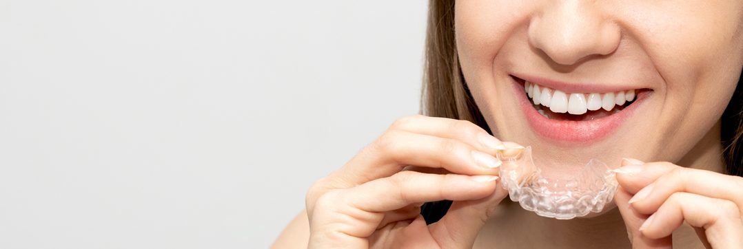 A Quick Guide To Eating And Drinking With Invisalign Aligners - Health ...