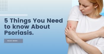 5 Things You Need to Know About Psoriasis - Health Benefits
