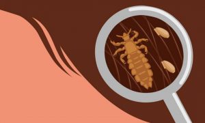 Some Myths and Facts of Lice Disease - Health Benefits