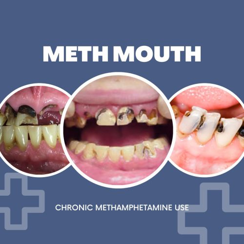 How These 10 Foods Affect Your Oral And Dental Health - Health Benefits