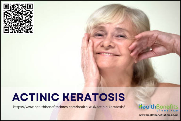 What is Actinic Keratosis? - Health Benefits