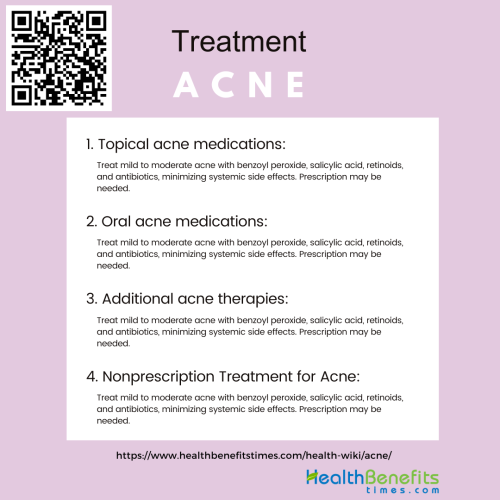 How is acne treated | Health Benefits