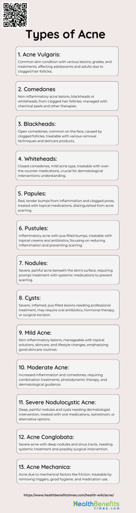 Types of Acne | Health Benefits