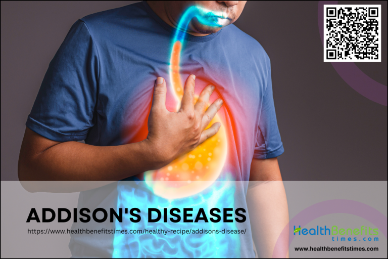 What is Addison's Diseases? - Health Benefits
