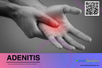 What is Adenitis? - Health Benefits