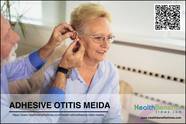 What is Adhesive Otitis Media (AOM)? - Health Benefits