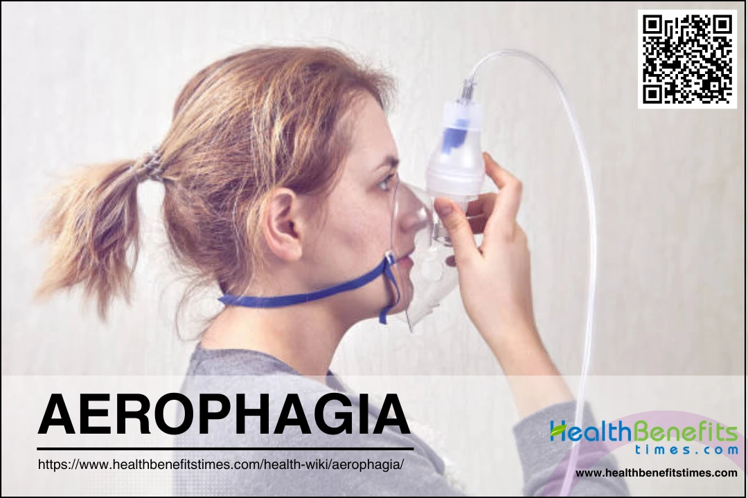 What is Aerophagia? - Health Benefits