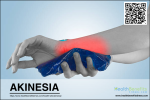What is Akinesia? - Health Benefits
