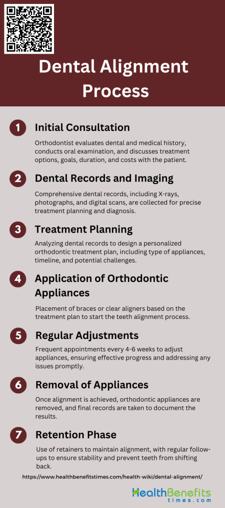 The A-Z of Dental Alignment: What You Need to Know - Health Benefits