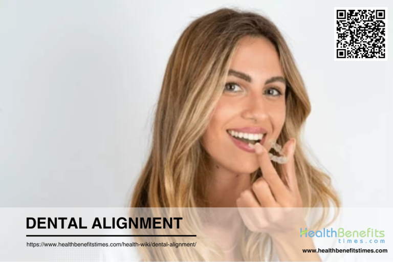 The A-Z of Dental Alignment: What You Need to Know - Health Benefits