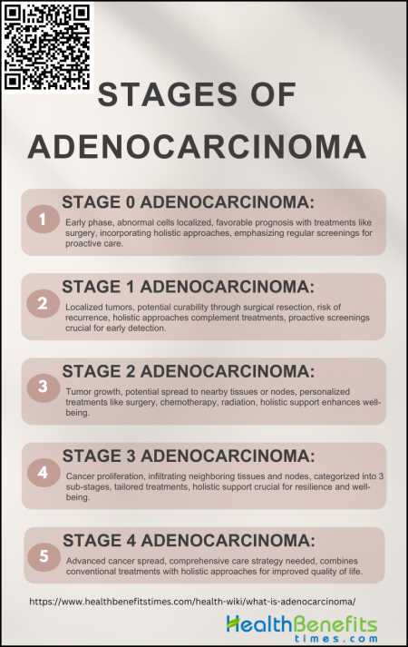Stages of Adenocarcinoma | Health Benefits