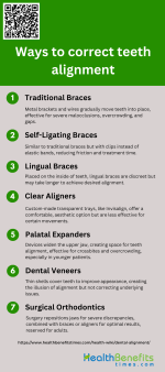 The A-Z of Dental Alignment: What You Need to Know - Health Benefits