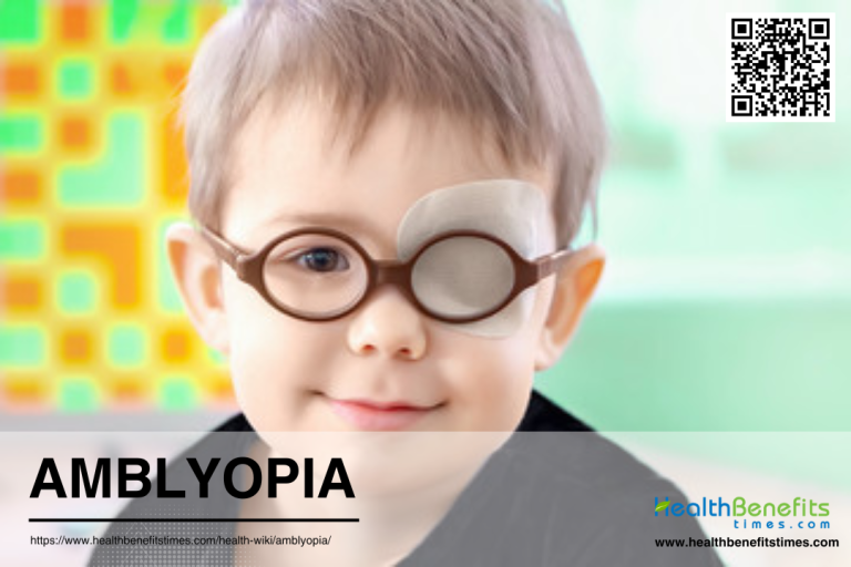 What is amblyopia? - Health Benefits