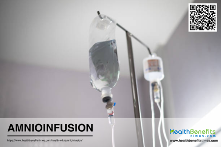 What is Amnioinfusion? - Health Benefits