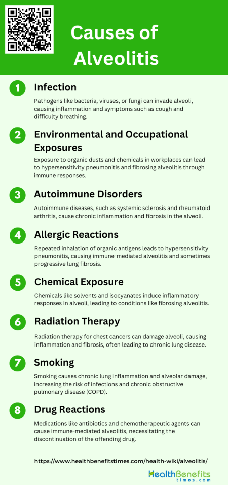 What is Alveolitis? Causes, Symptoms and Treatment - Health Benefits