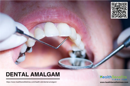 What is Dental amalgam? - Health Benefits