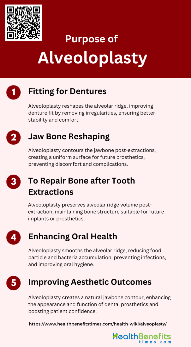 What is Alveoplasty? - Health Benefits