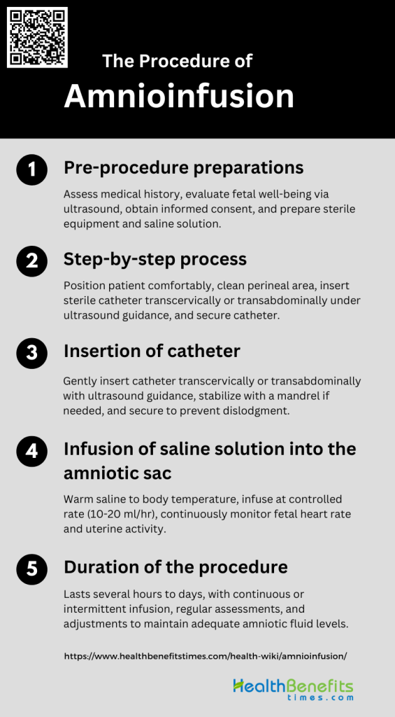 What is Amnioinfusion? - Health Benefits