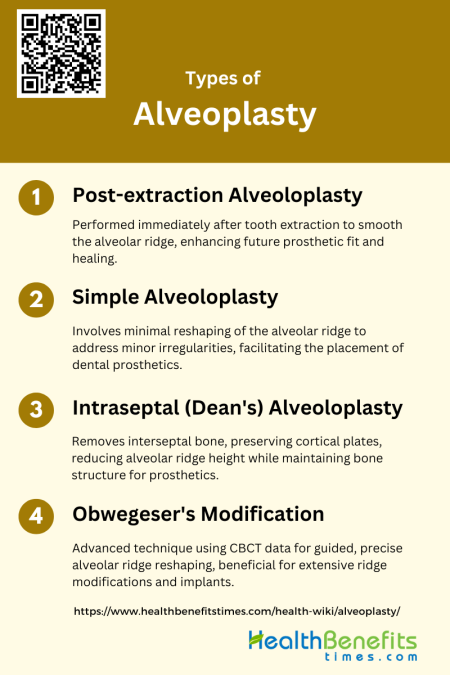 What is Alveoplasty? - Health Benefits