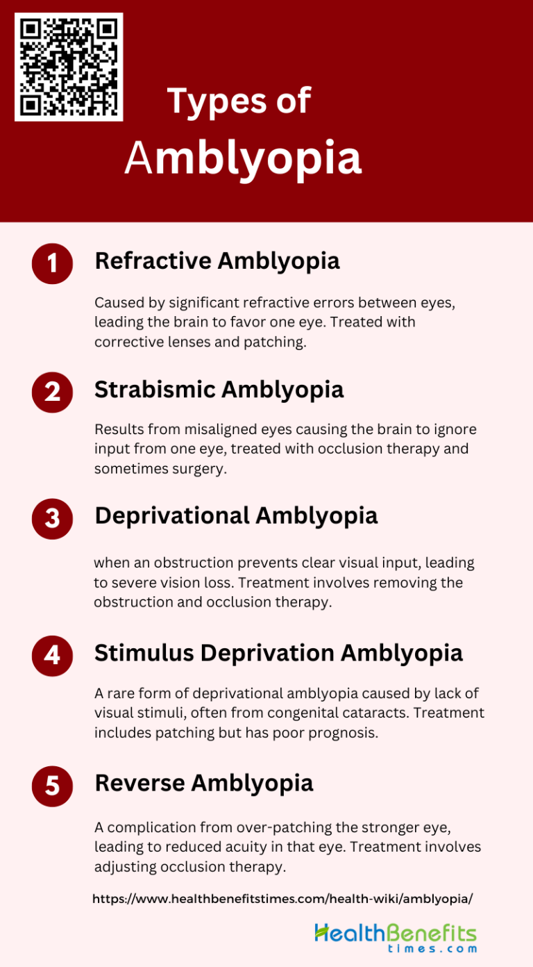 What is amblyopia? - Health Benefits
