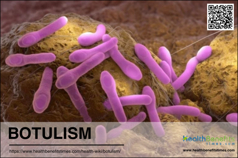 What is Botulism: Types, Causes, Symptoms - Health Benefits