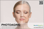 What is Photoaging (Sun-damaged Skin) Signs, Causes & Treatment ...