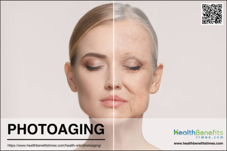 What is Photoaging (Sun-damaged Skin) Signs, Causes & Treatment - Health Benefits
