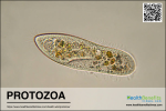 What is Protozoa: Types and Risks - Health Benefits