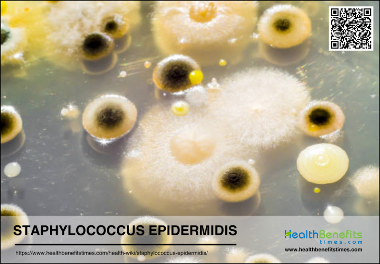 What is Staphylococcus Epidermidis and Its role in skin health - Health ...