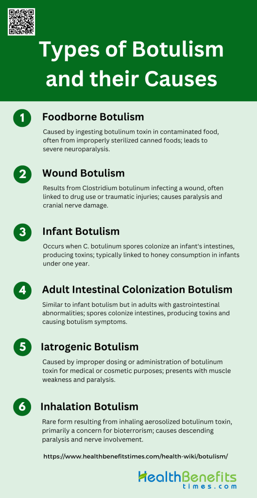 Types of Botulism and their Causes (1) | Health Benefits