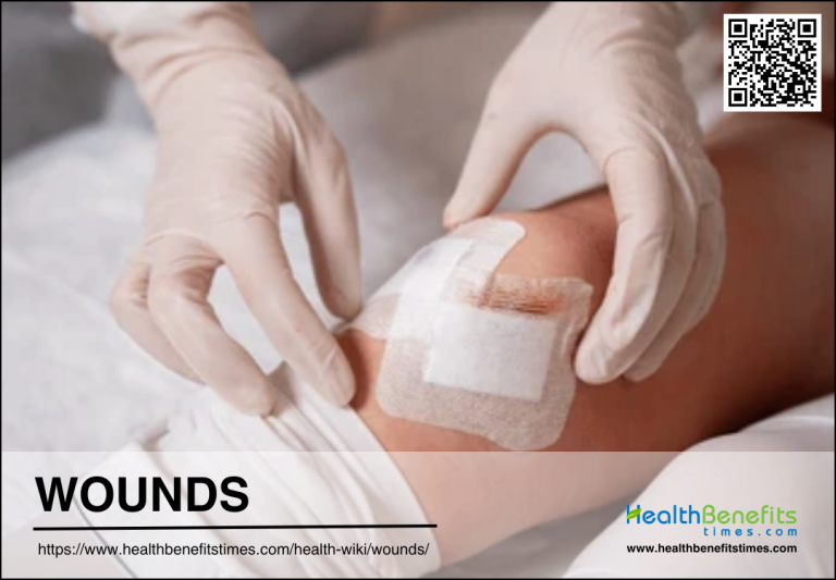 What are Wounds: Types and Treatments. - Health Benefits