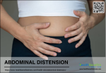 What is Abdominal Distension? Purpose and Procedure - Health Benefits