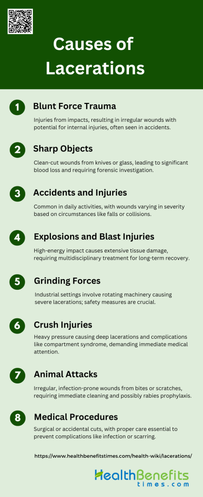 What is Lacerations? - Health Benefits