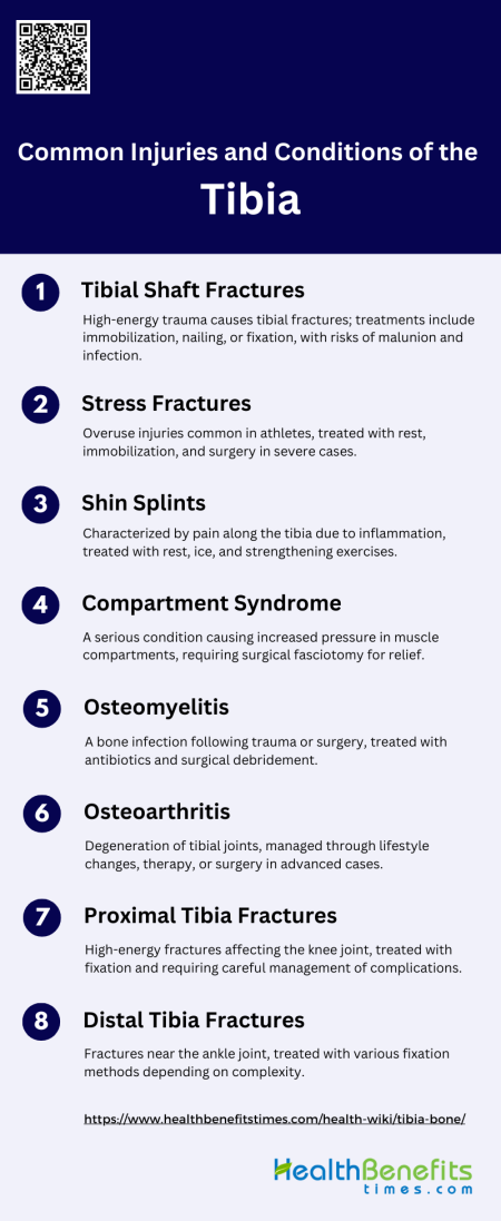 What is Tibia Bone: Function, location - Health Benefits