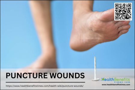 What are Puncture wounds? - Health Benefits