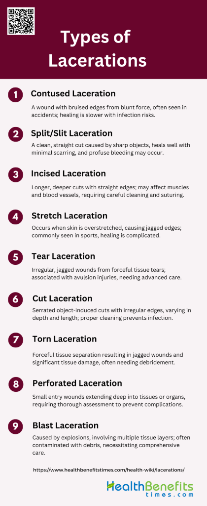 Types of Lacerations | Health Benefits