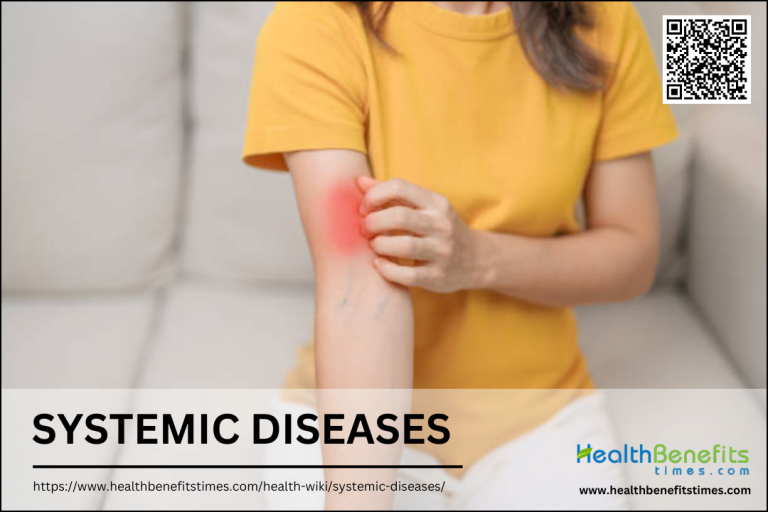 What are Systemic Diseases? - Health Benefits