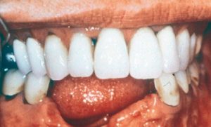 Atrophic - Definition of Atrophic