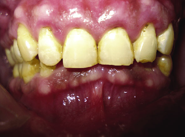 Butt - Definition of Butt