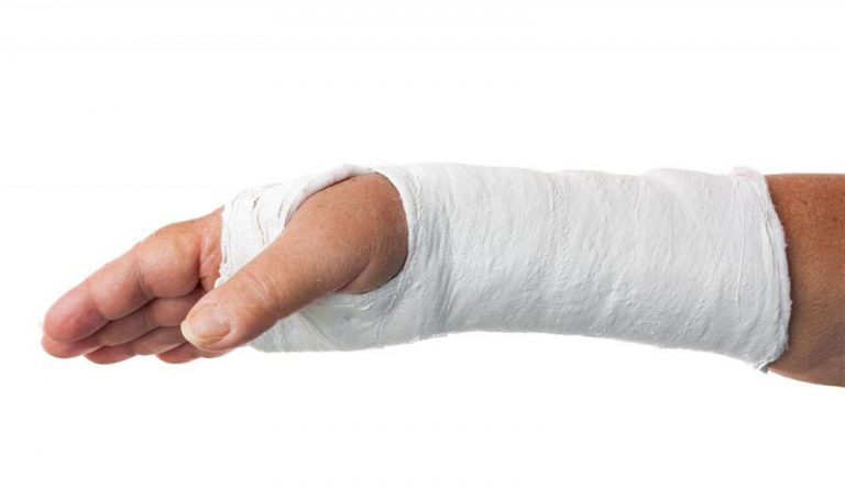 Calcium sulfate - Definition of Calcium sulfate