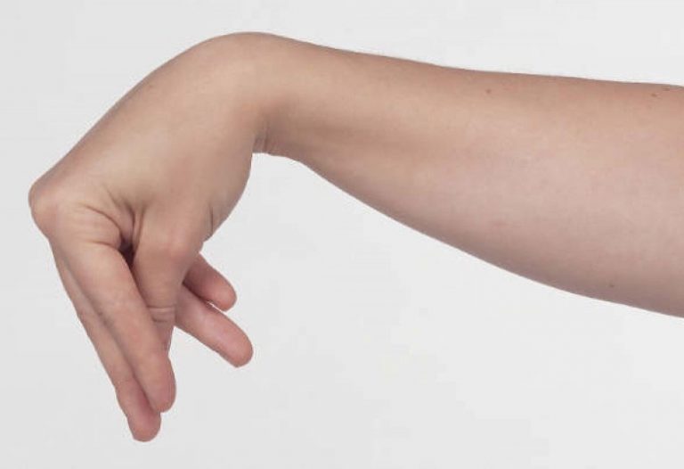 Carotenodermia - Definition of Carotenodermia