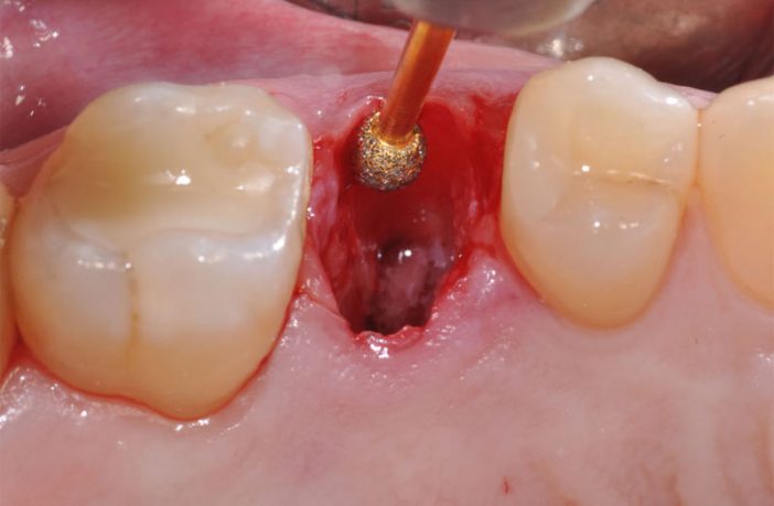 Socket - Definition of Socket
