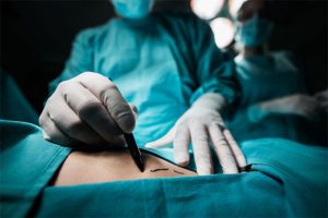 Surgery - Definition of Surgery