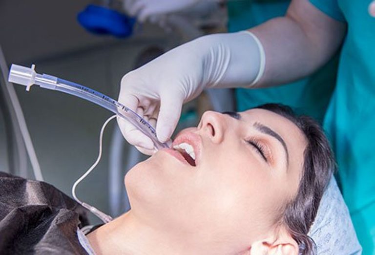 Intubation - Definition of Intubation