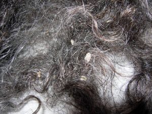 Scurf - Definition of Scurf