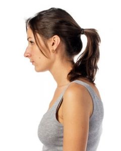 Forward head - Definition of Forward head