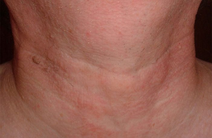 Neck - Definition of Neck