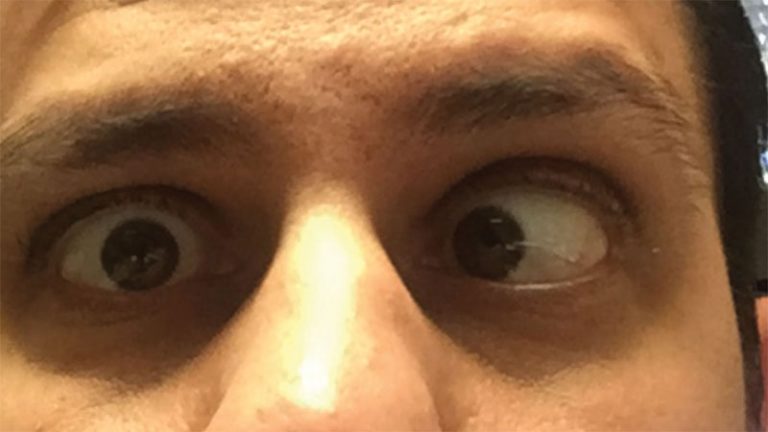 Diplopia - Definition of Diplopia