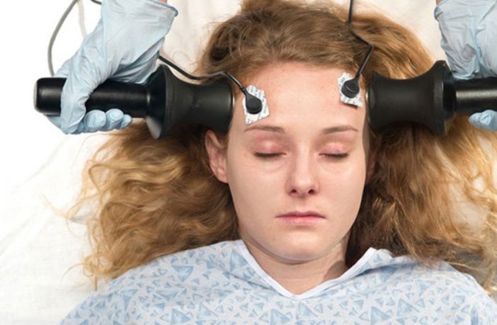 Electroconvulsive therapy (ECT) - Definition of Electroconvulsive ...